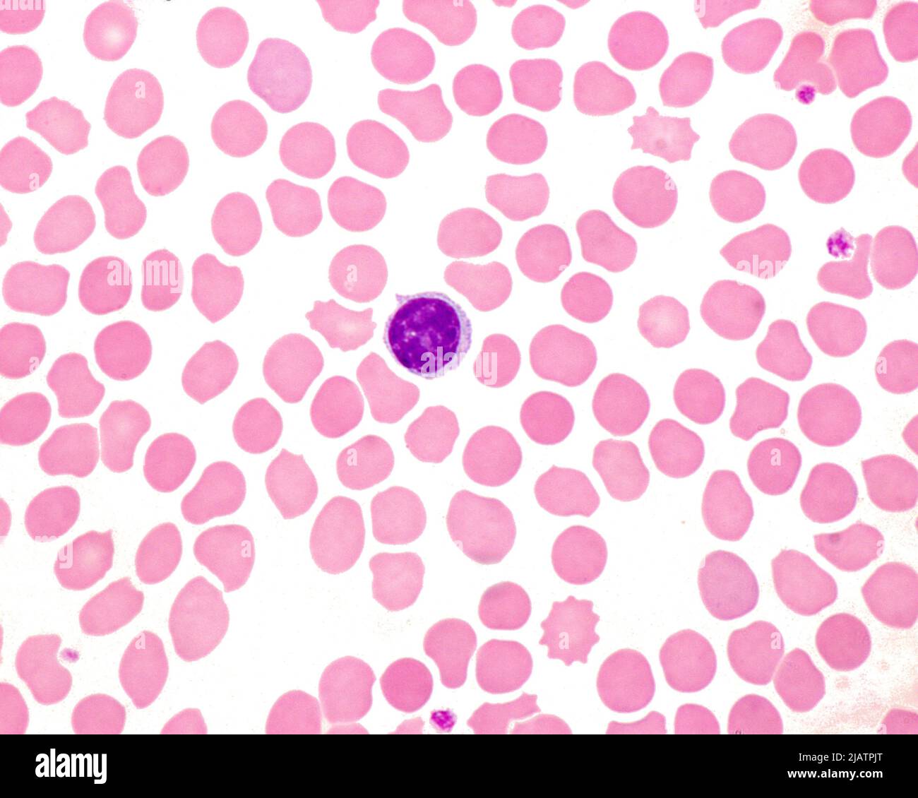 Human blood smear with lymphocyte, light micrograph Stock Photo - Alamy