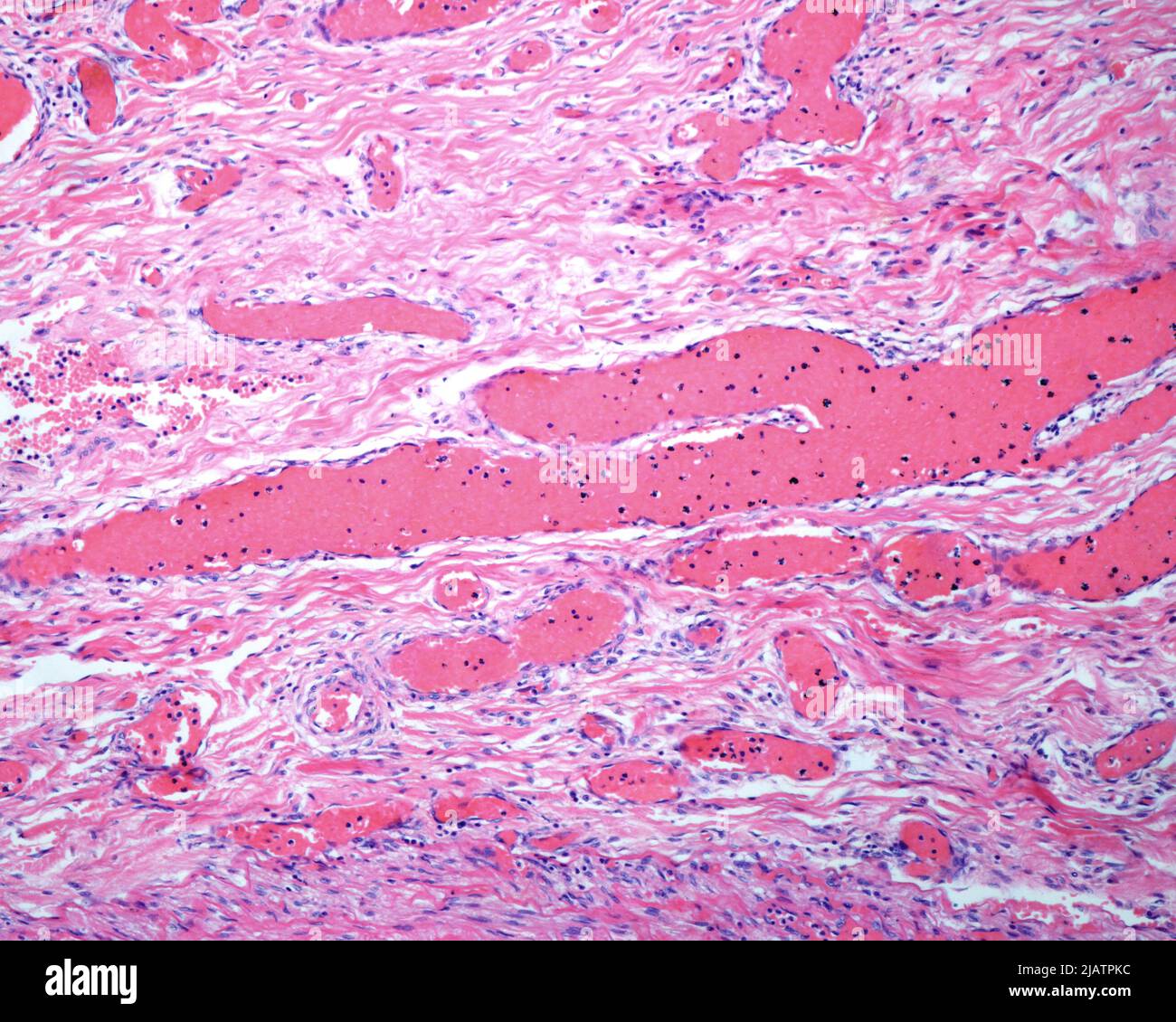 Small blood vessels, light micrograph Stock Photo - Alamy