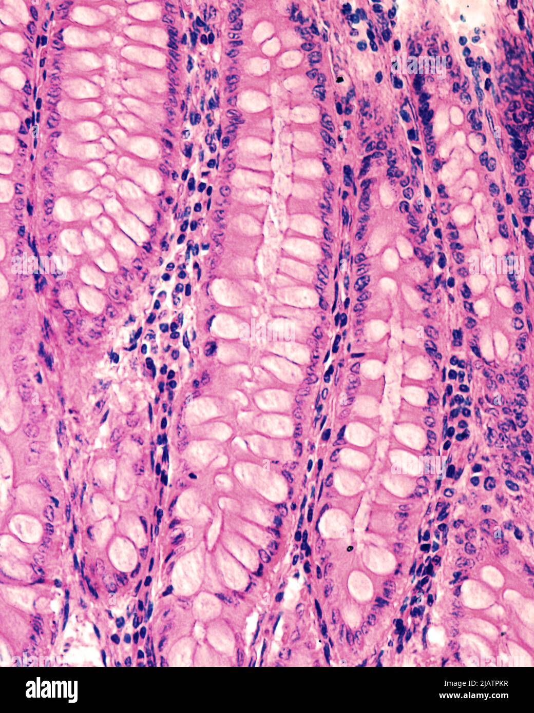 Mucosal crypts in human colon, light micrograph Stock Photo - Alamy