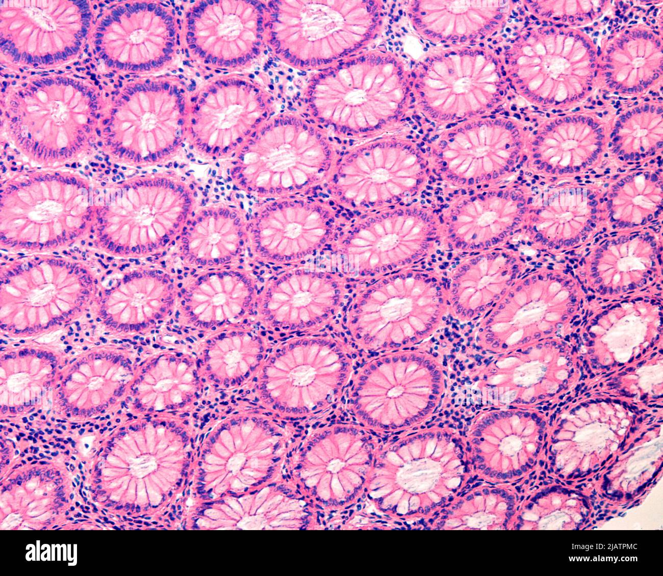 Mucosal crypts in human colon, light micrograph Stock Photo - Alamy