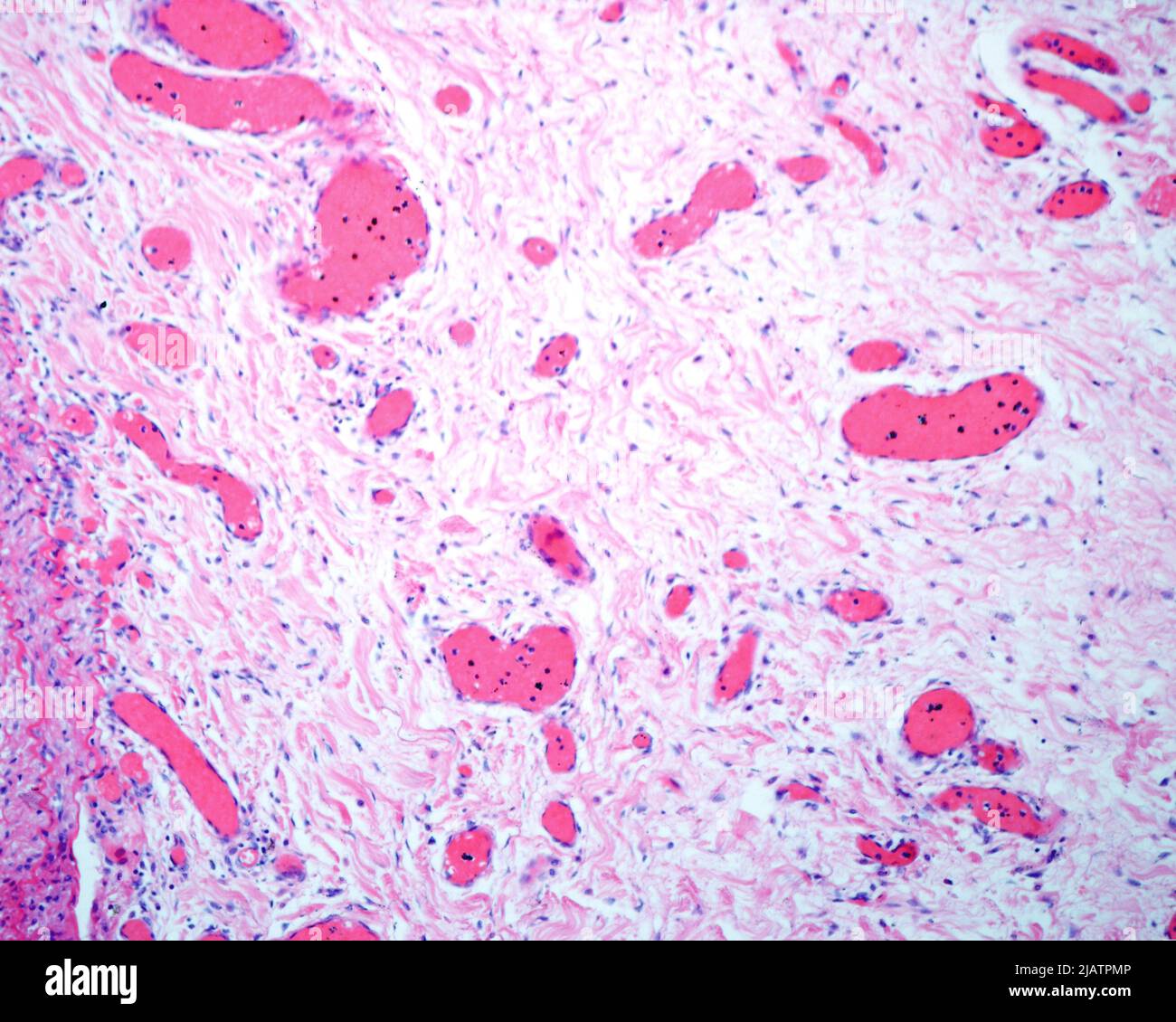 Small blood vessels, light micrograph Stock Photo - Alamy