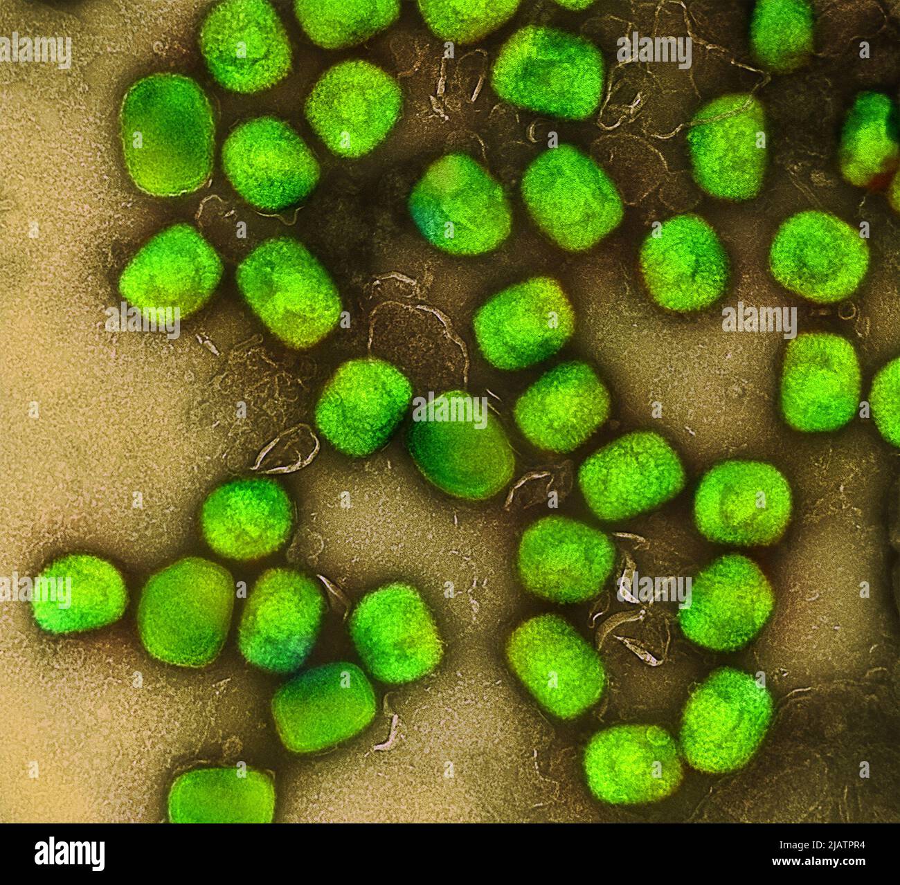 Monkeypox virus particles, TEM Stock Photo - Alamy