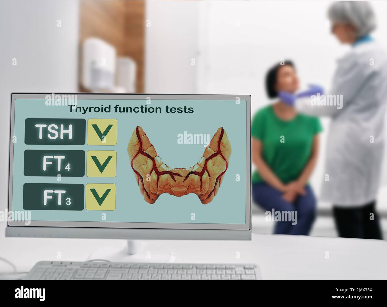 Monitor with thyroid illustration on the doctor's table, from behind ...