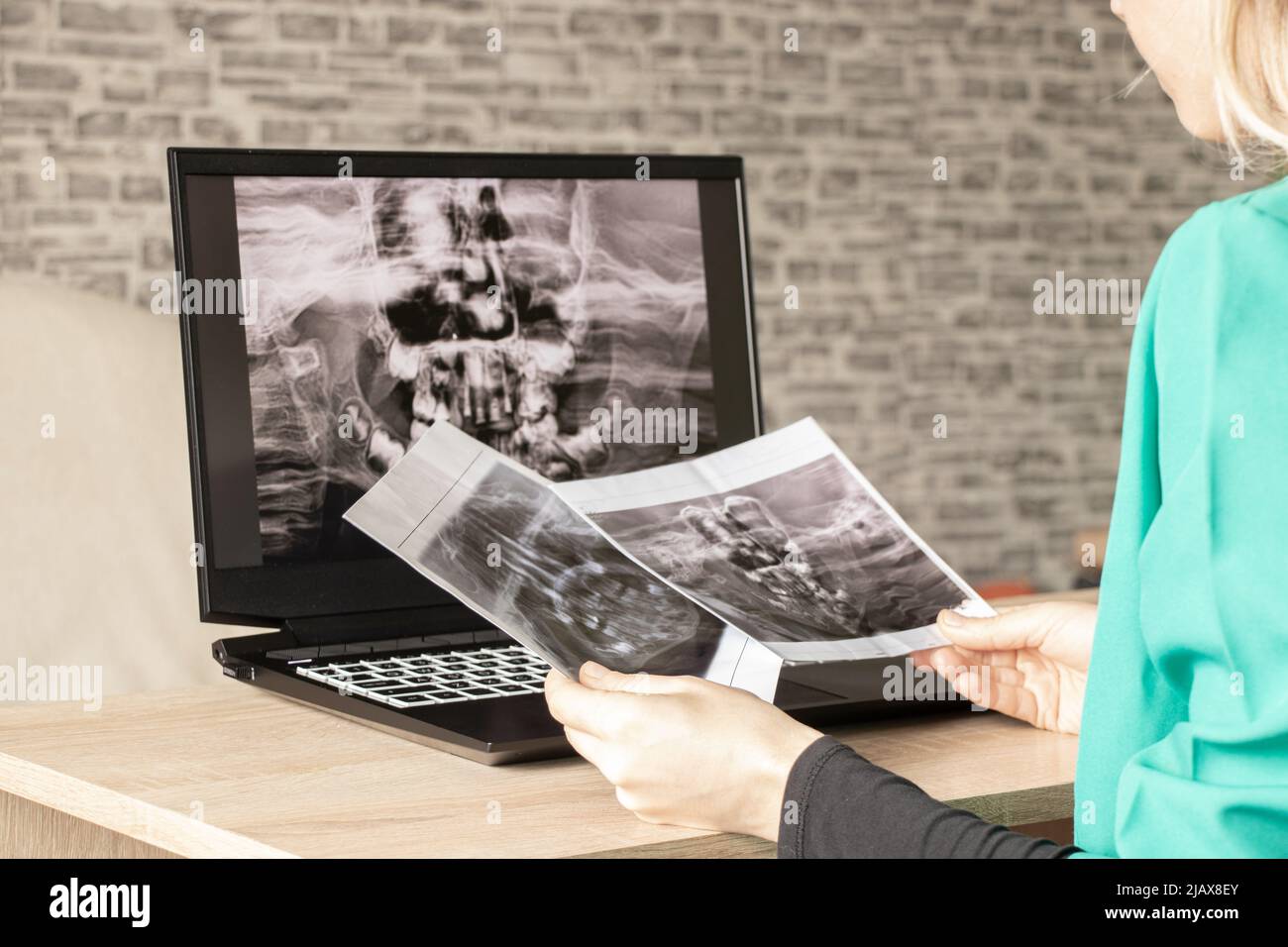 panoramic X-ray of children's teeth of two jaws, orthopantomogram of ...
