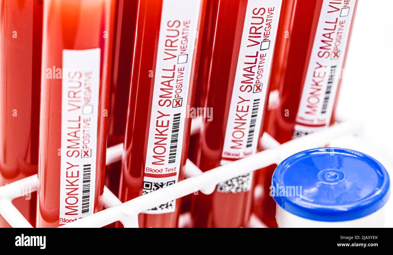 monkeypox contaminated blood test, smallpox test result indicating ...