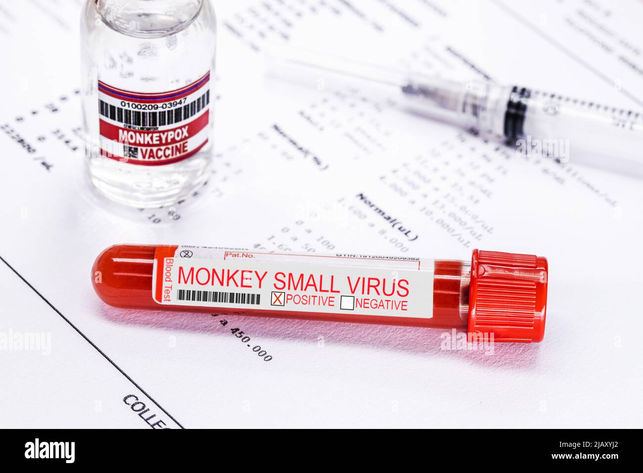 blood collection tube with contaminated material, positive blood for ...