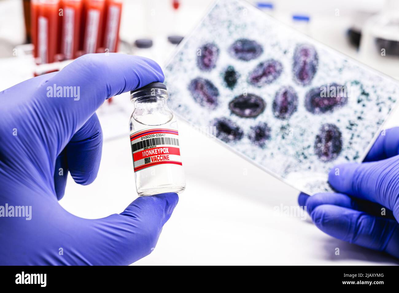 pharmacist's hand with latex glove holding monkeypox vaccine, with ...