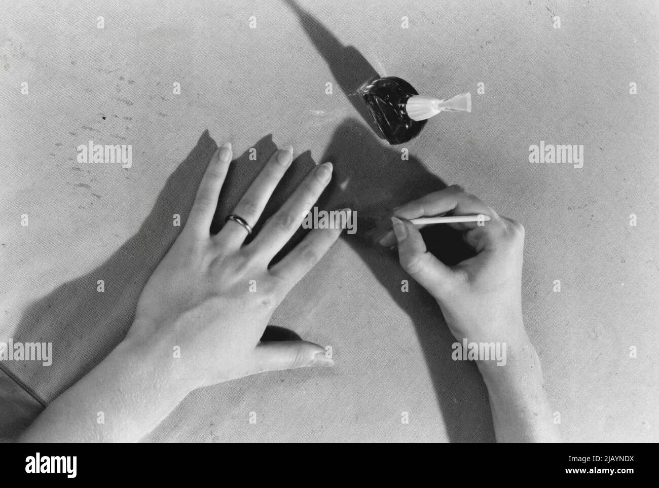Cuticle wound hi-res stock photography and images - Alamy