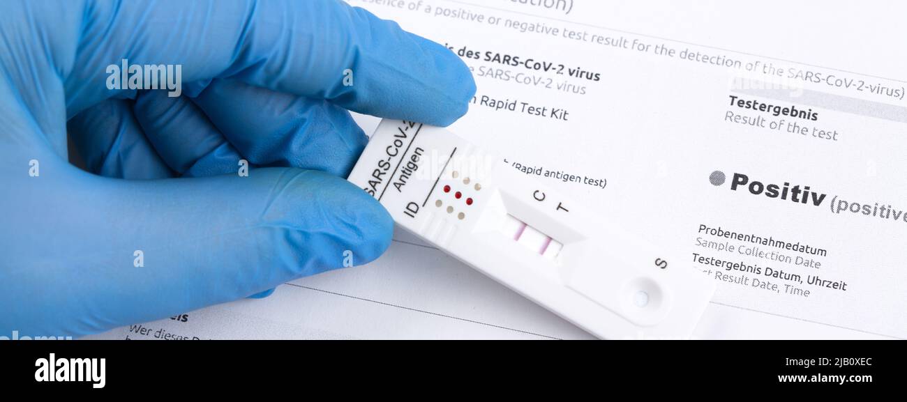 Express corona test. Positive covid antigen test Stock Photo - Alamy