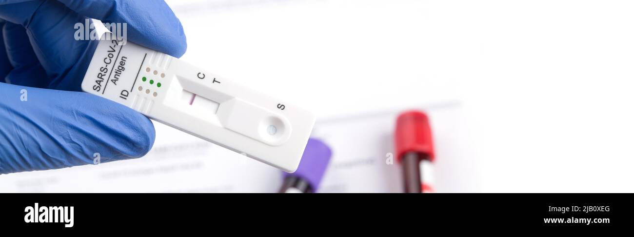 Express corona test. Negative covid antigen test Stock Photo - Alamy