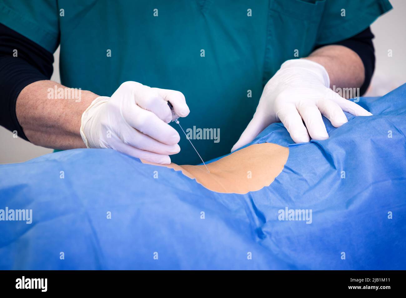 Ultrasound-guided infiltrative therapy for back pain treatment. Doctor ...