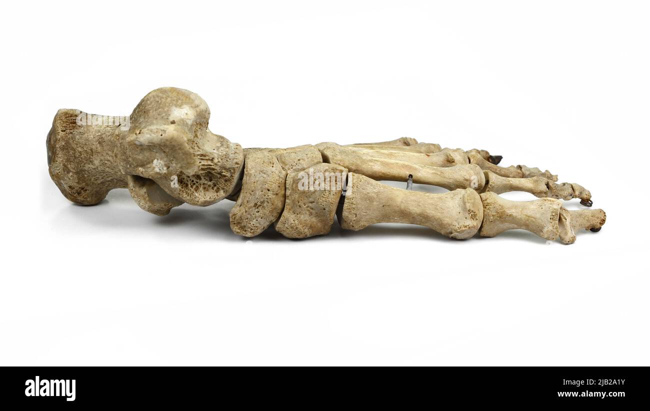 Left foot bone. Foot bone, ankle bone For teaching medical students ...