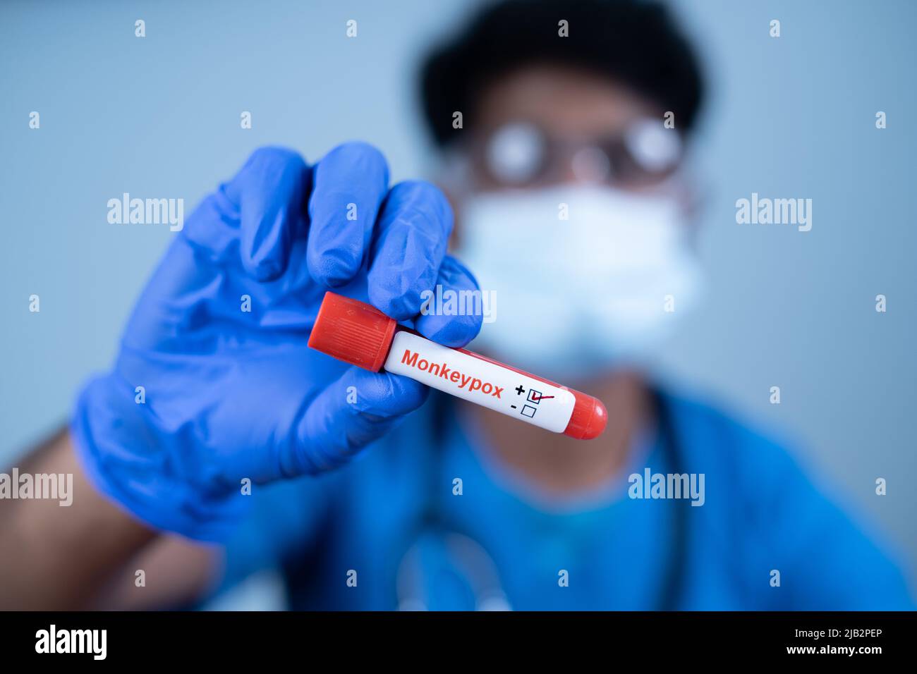 close up shot of doctor showing Monkeypox positive test of laboratory ...
