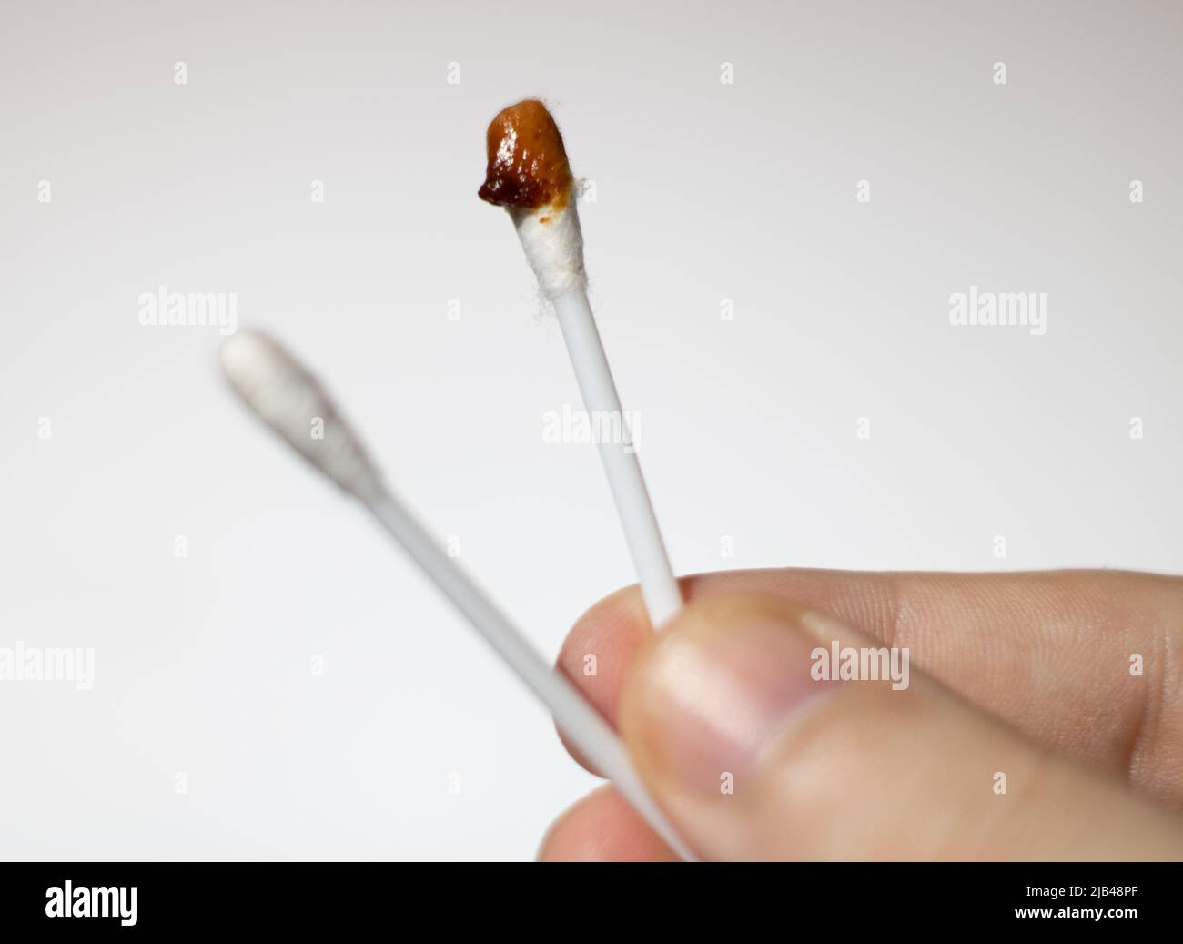 Unclean ear tech hi-res stock photography and images - Alamy