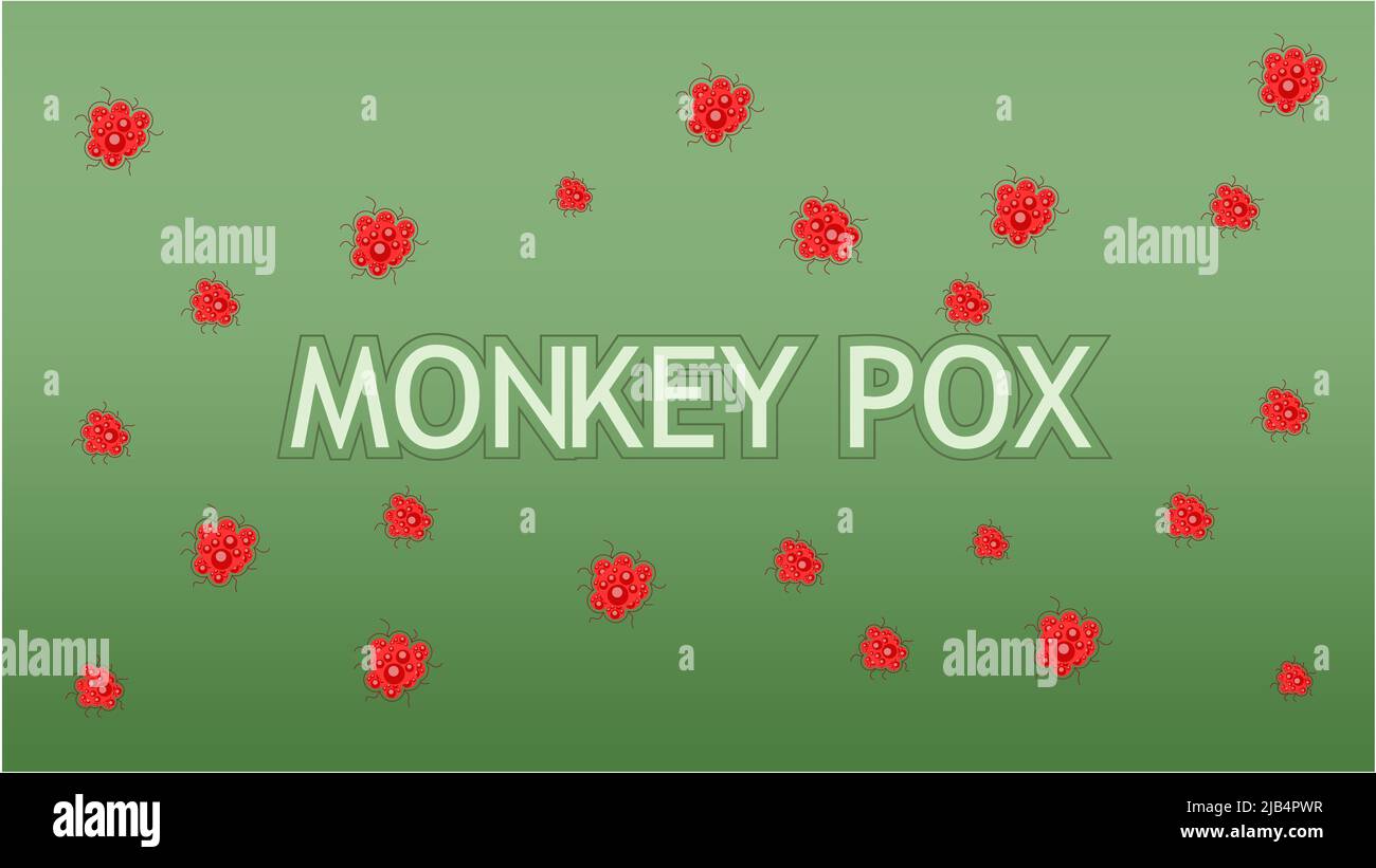 Monkeypox concept, illustration of monkeypox skin urticaria, Vector ...