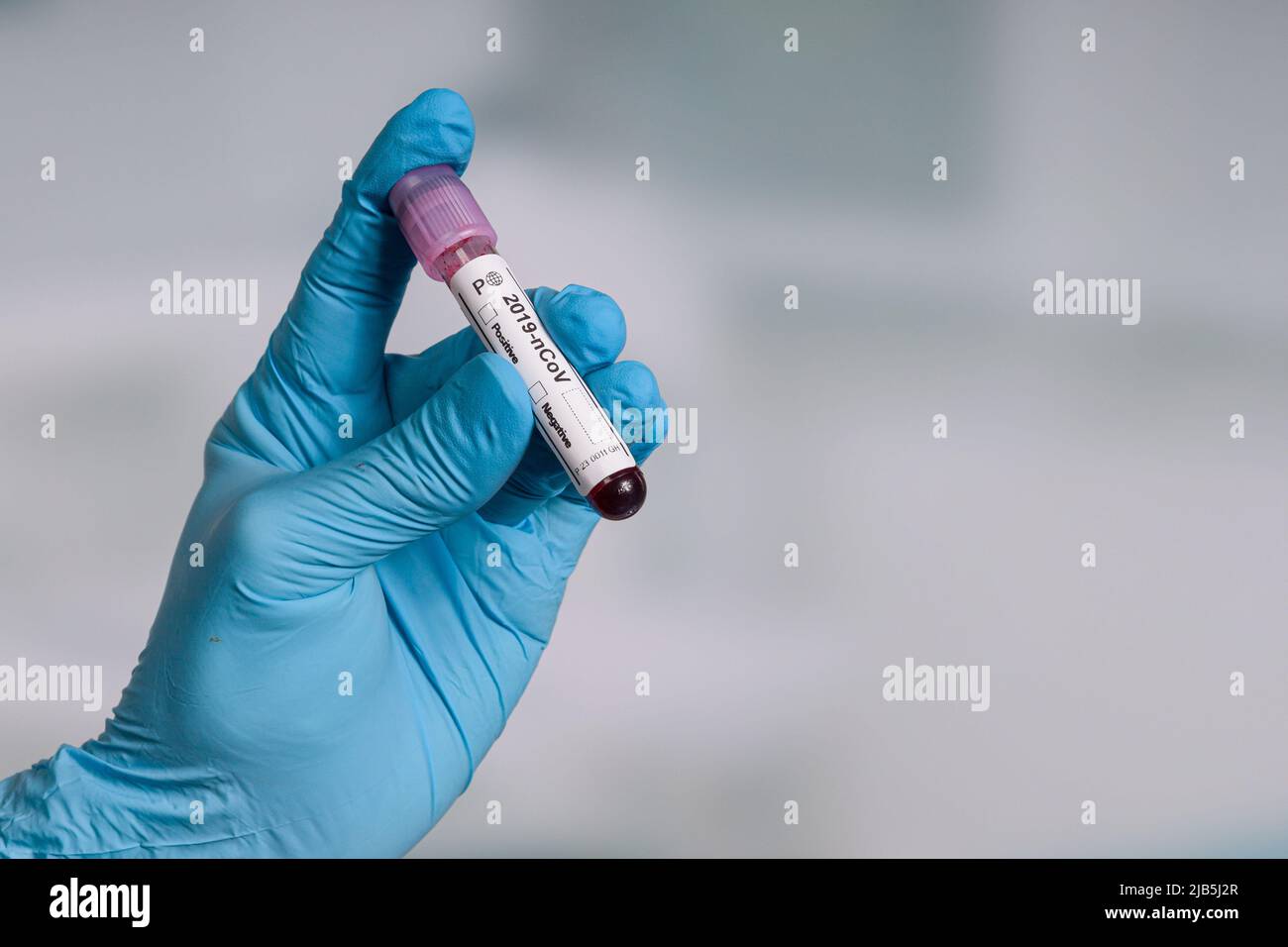 Haemoglobin analysis hi-res stock photography and images - Alamy