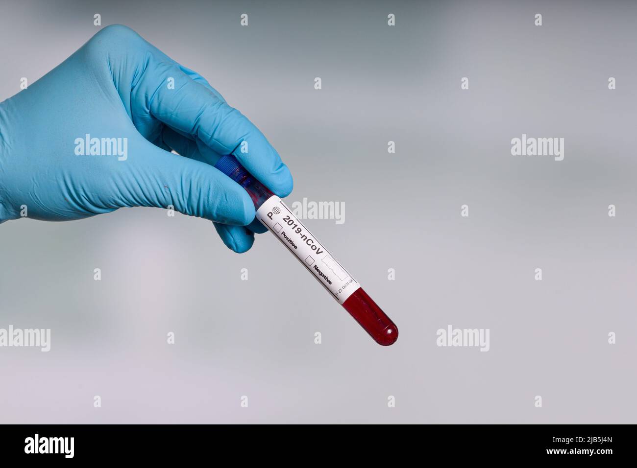 hand in blue gloves holding a blood test tube in front of a lab room ...