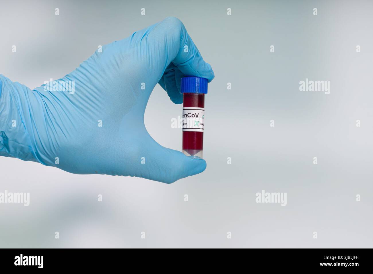 hand in blue gloves holding a blood test tube in front of a lab room ...