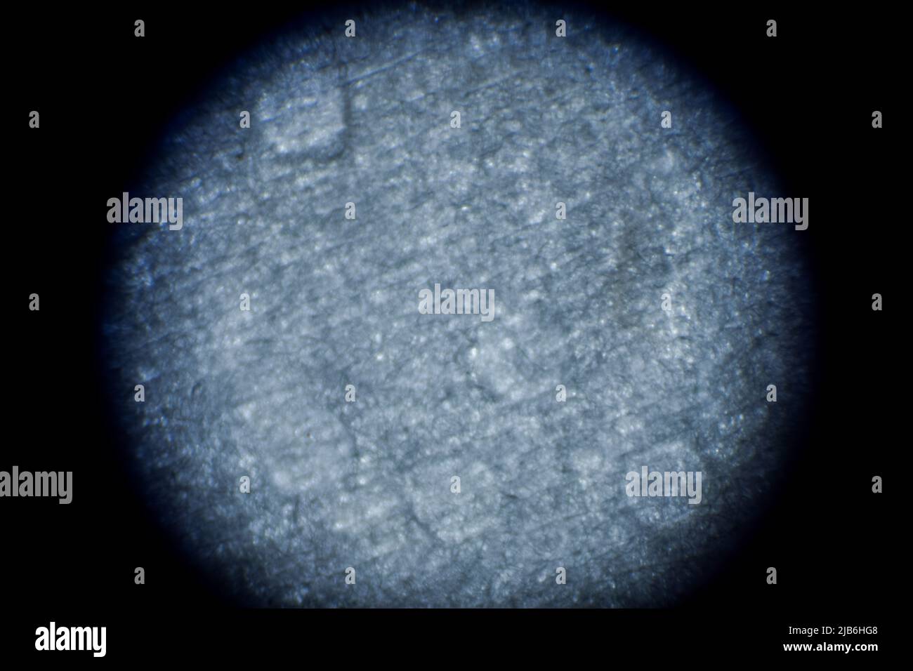 Fetal image hi-res stock photography and images - Alamy