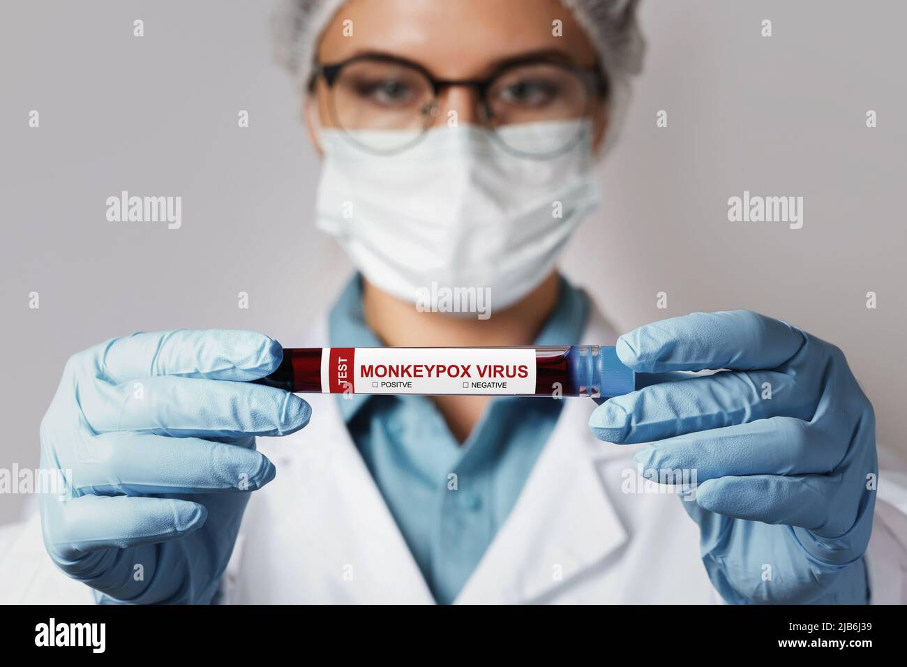 Closeup of female nurse with vacutainer with monkeypox blood sample for ...