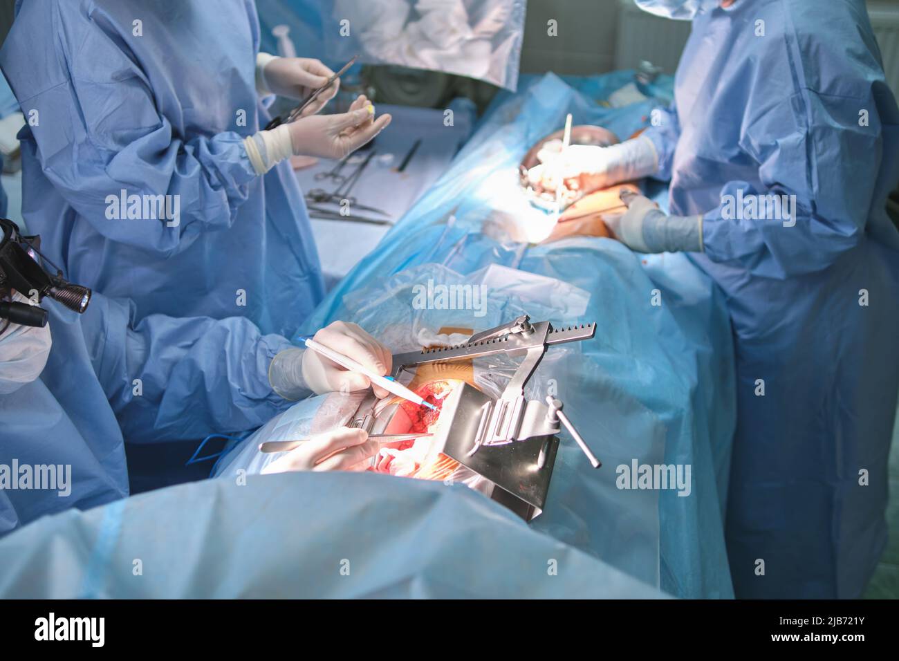 Team of professional doctors operating a patient conducting open heart ...