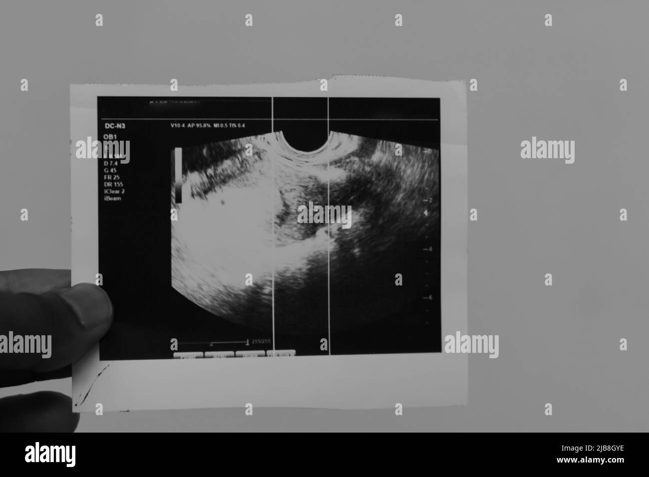pregnant women sonogram with blurred background from flat angle Stock ...