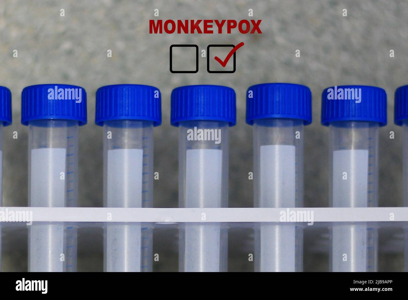 Laboratory tube shows monkeypox virus Stock Photo - Alamy
