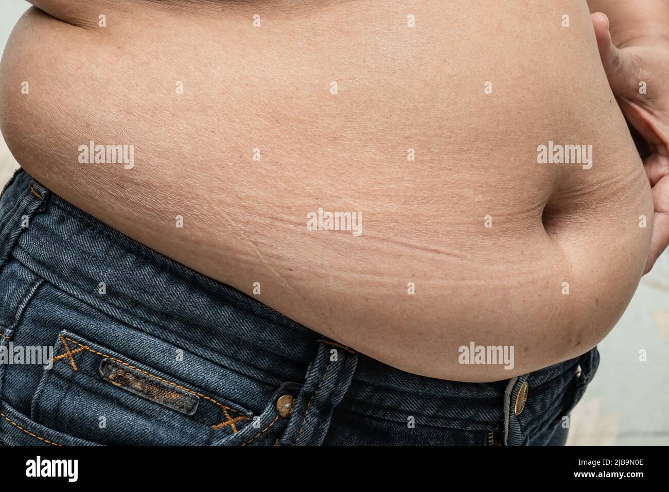 Overweight Asian woman show fat belly to burn and loss weight and limit ...