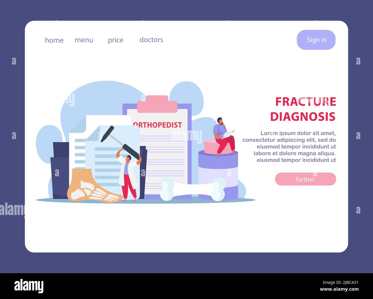 Fracture bone infographics hi-res stock photography and images - Alamy