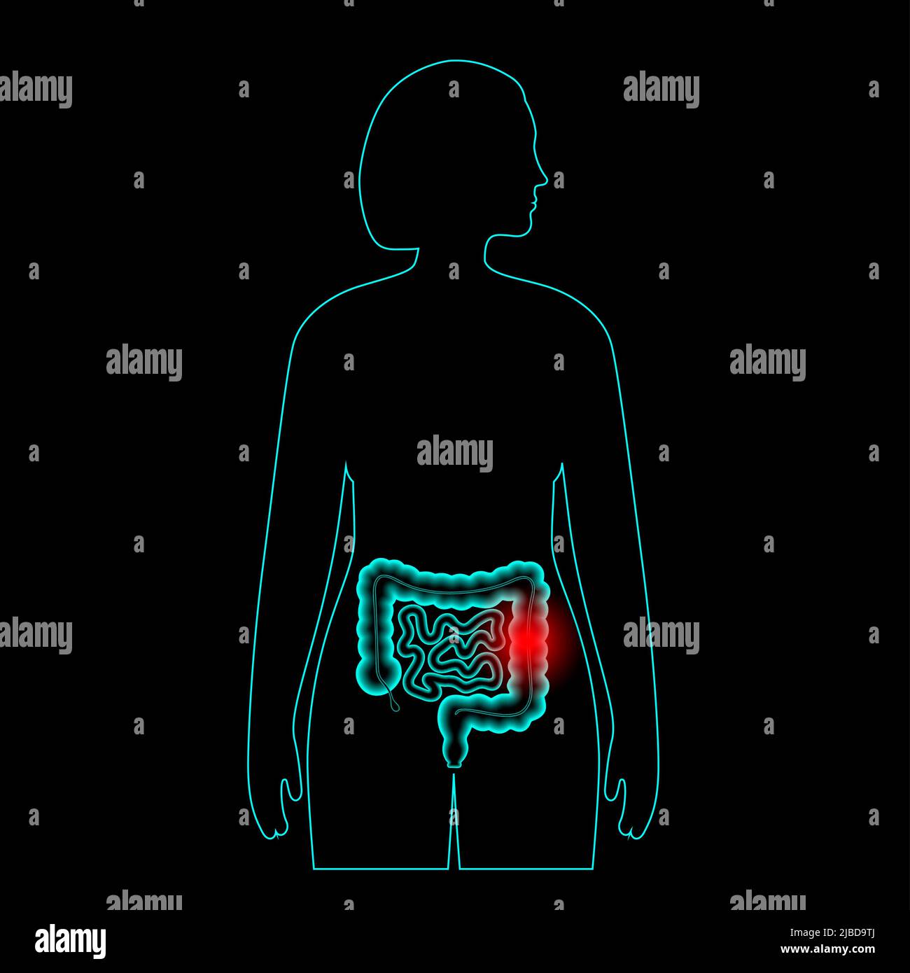 Inflammatory bowel disease woman hi-res stock photography and images ...