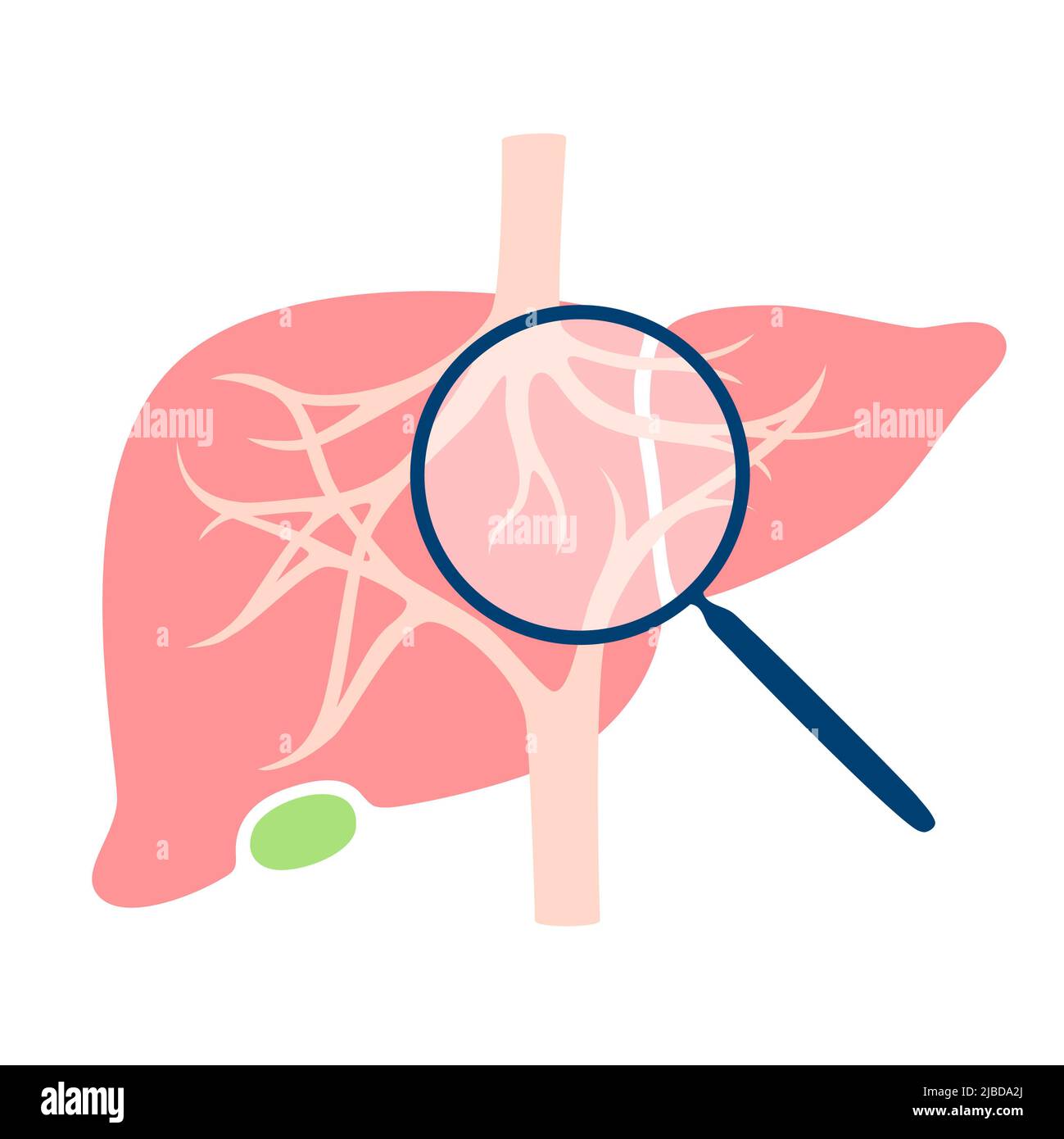 Liver disease, conceptual illustration Stock Photo - Alamy