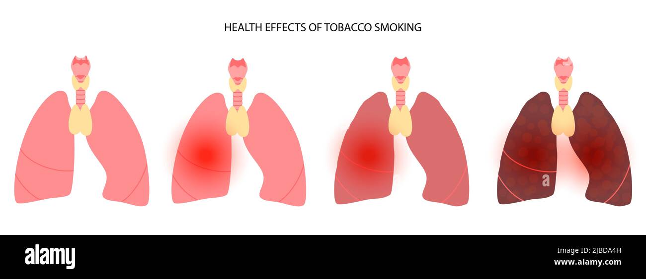 Tobacco effects hi-res stock photography and images - Alamy