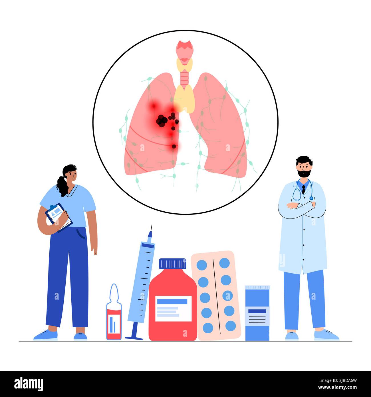 Lungs cancer, illustration Stock Photo - Alamy