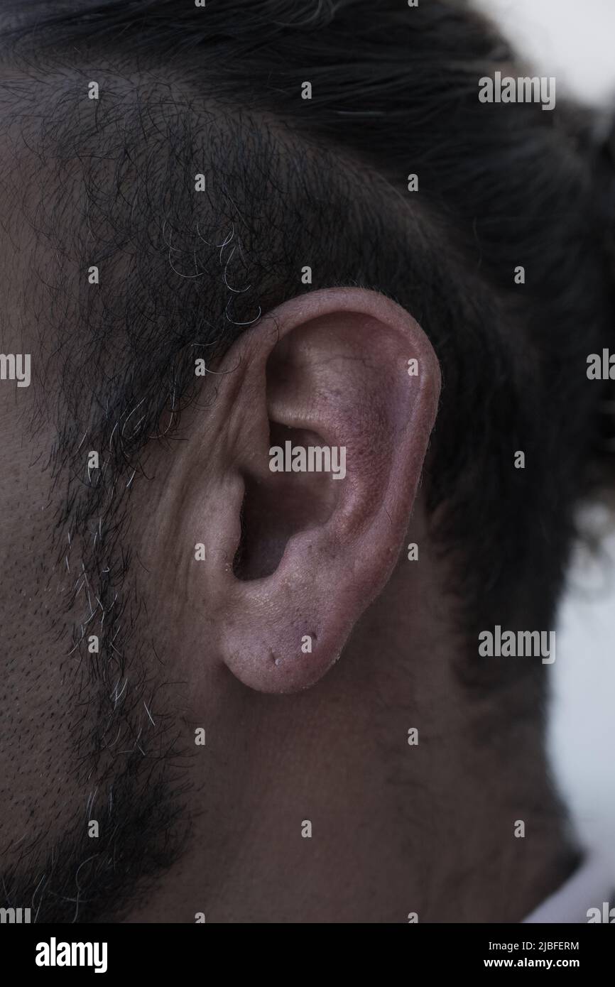 Ear wax ear hi-res stock photography and images - Alamy