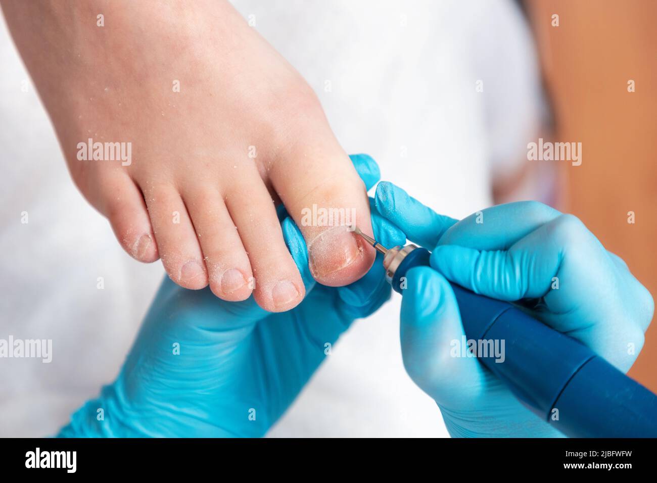 A chiropodist treats the cuticles on the toes with a mechanical device ...