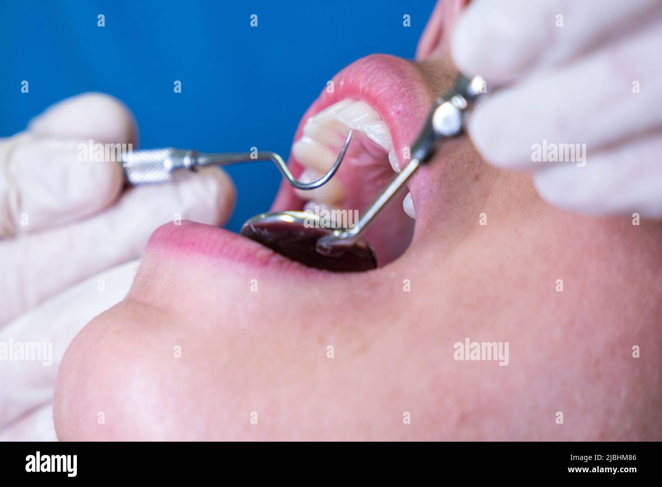 Dentist with scaler and mirror checking a patient's mouth Stock Photo ...