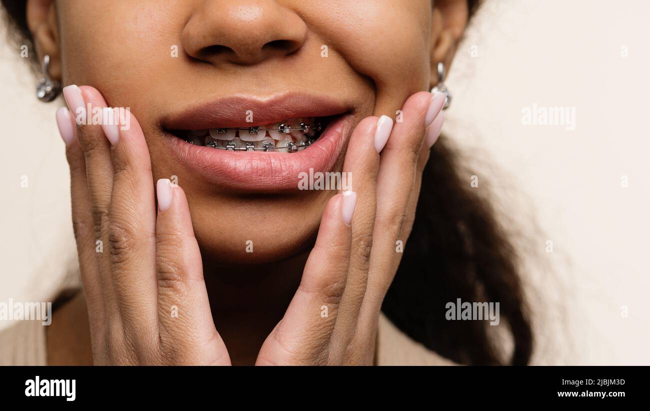 Shy unrecognizable african american female model demonstrates braces ...