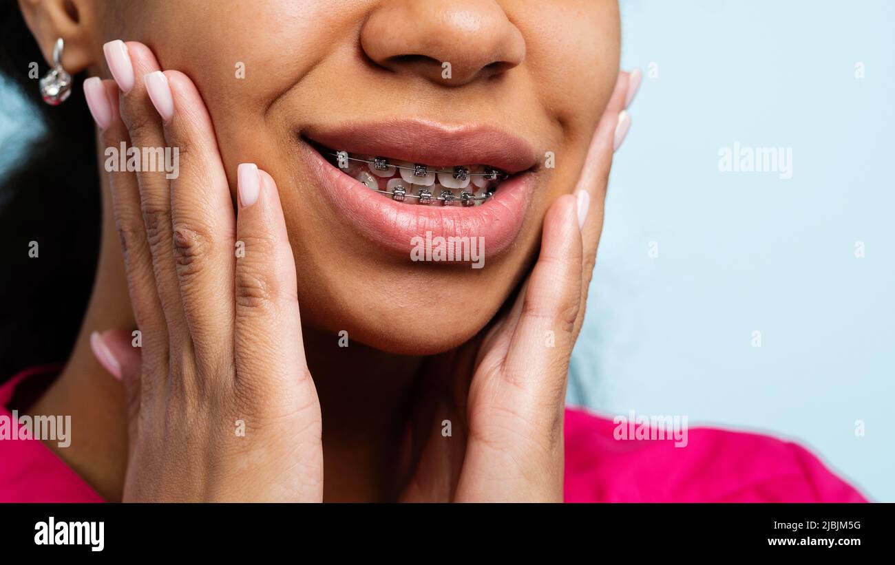 Closeup unrecognizable african american woman girl in braces smiles and ...