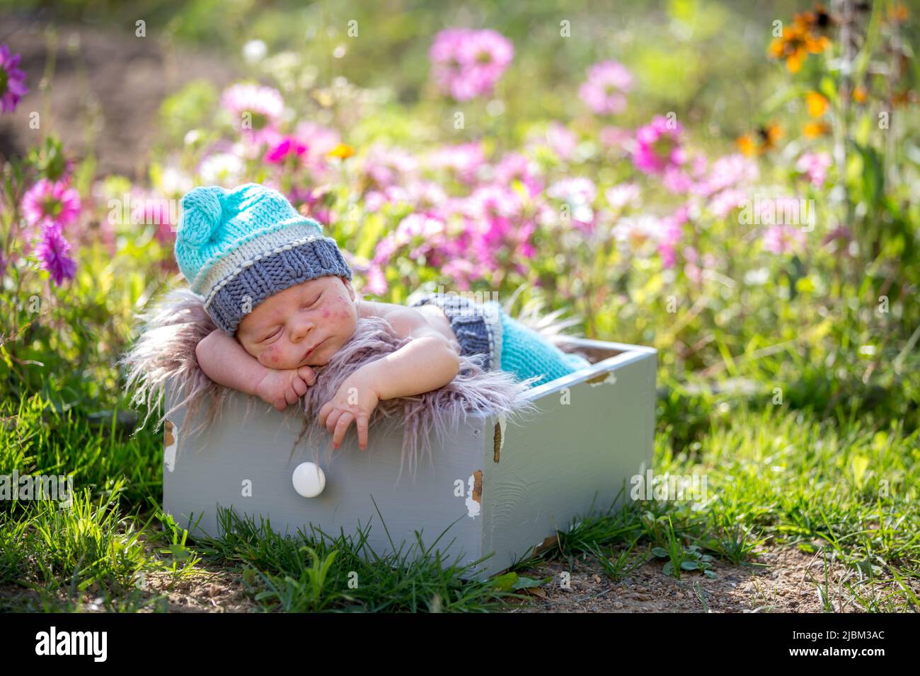 Cute newborn baby child, boy with severe skin rash, sleeping peacefully ...