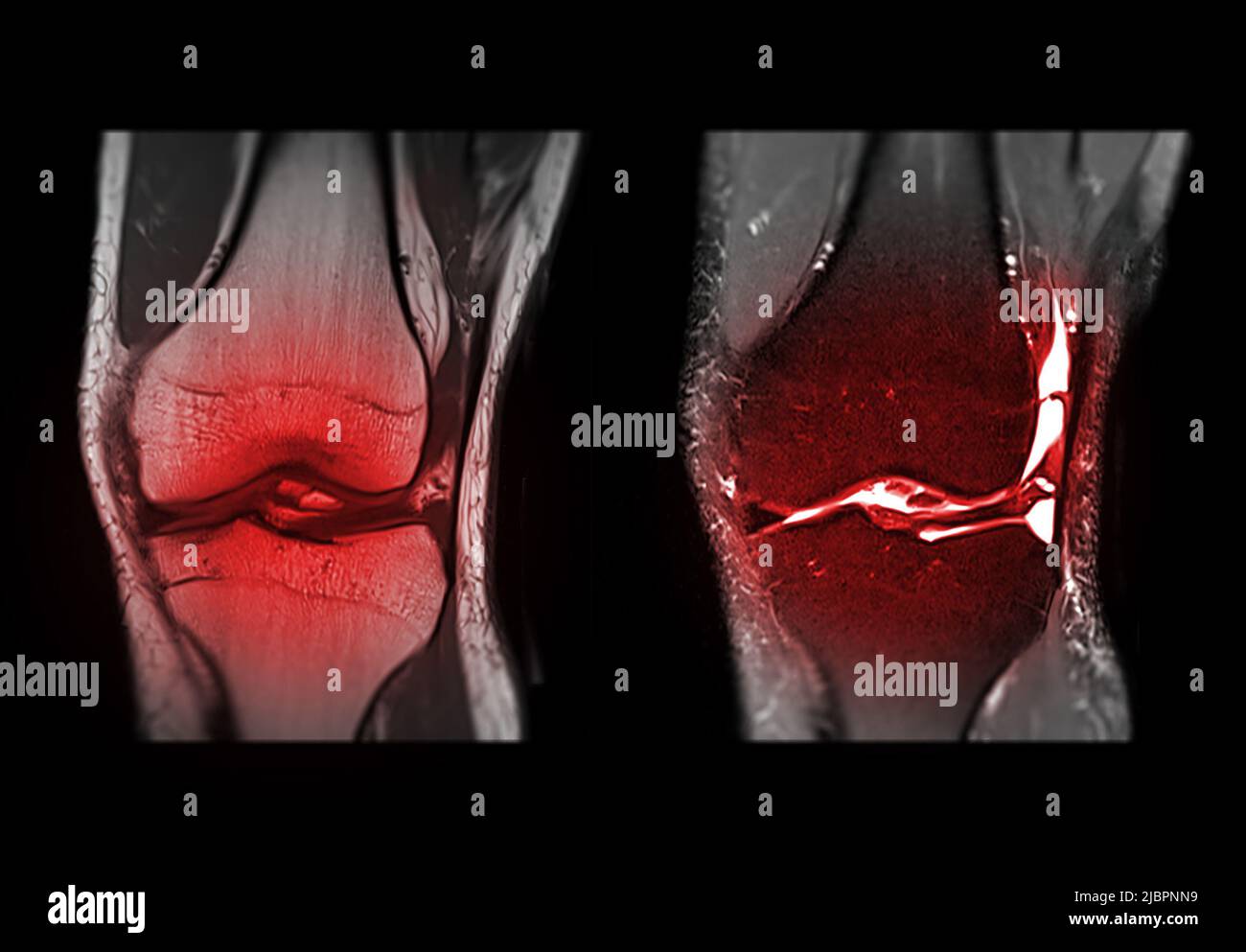 Anterior knee hi-res stock photography and images - Alamy