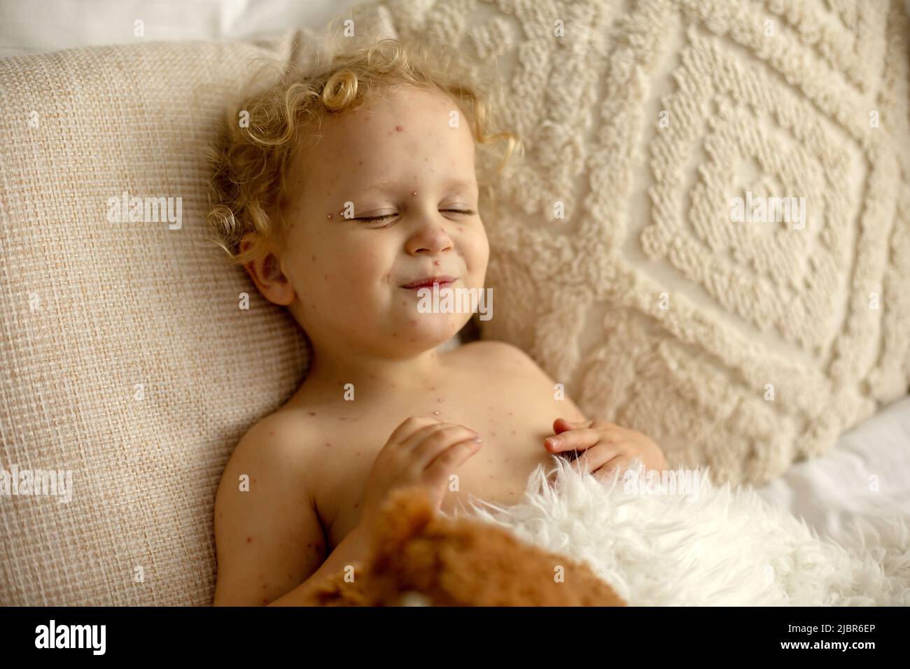 Little toddler girl with chickenpox in bed, playing at home, quarantine ...