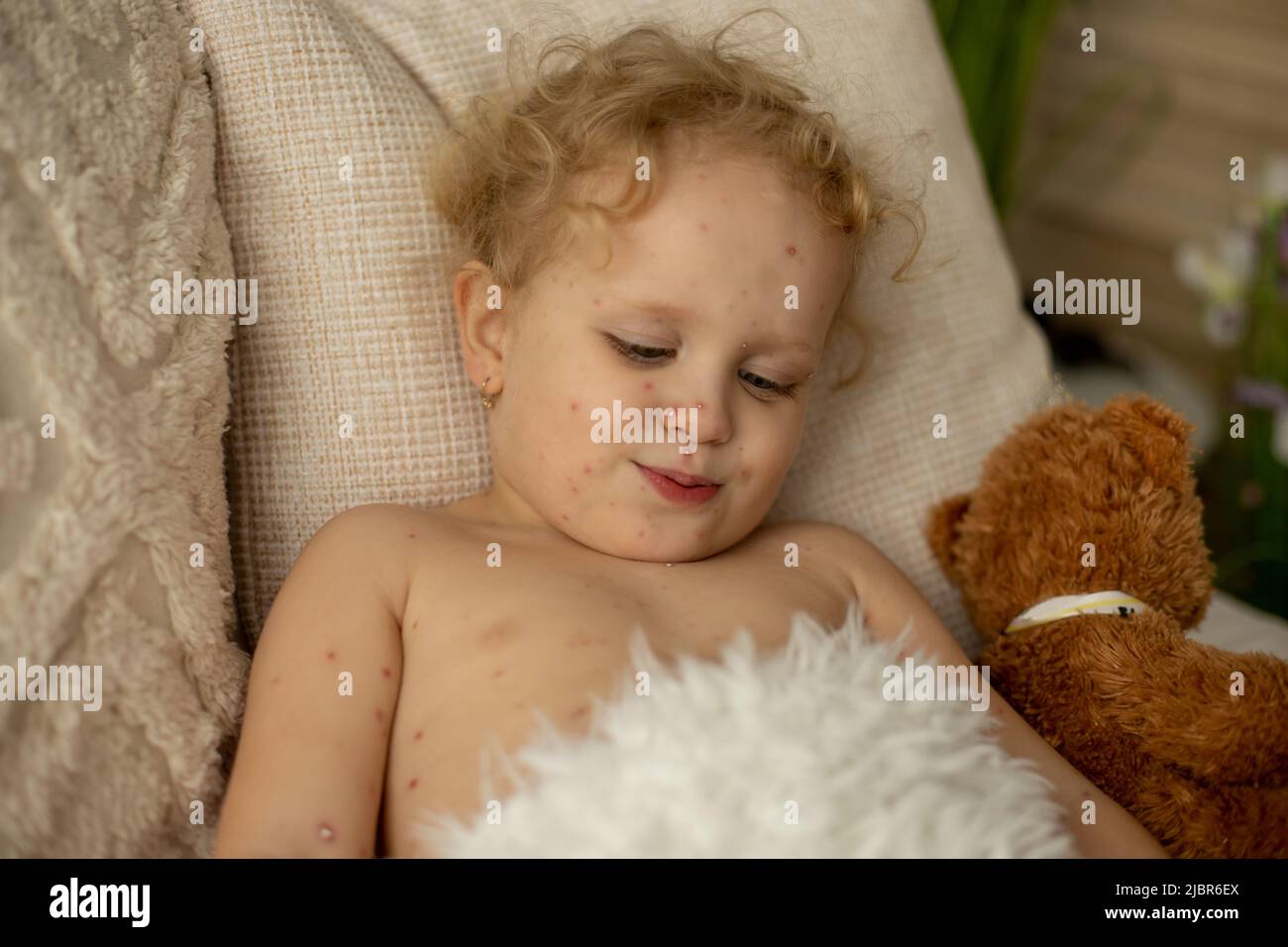 Little toddler girl with chickenpox in bed, playing at home, quarantine ...