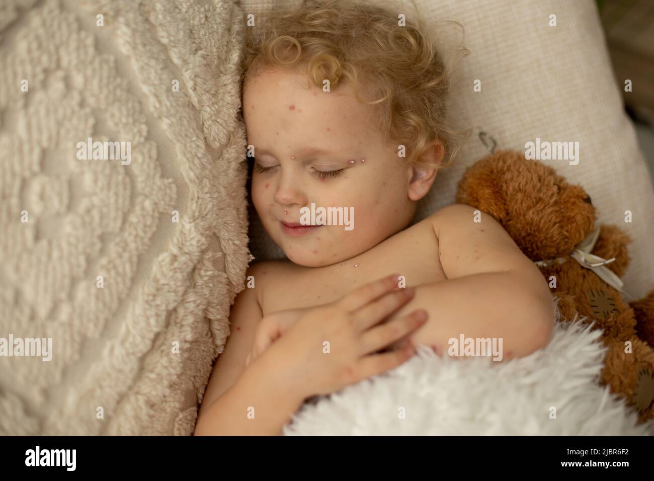 Little toddler girl with chickenpox in bed, playing at home, quarantine ...