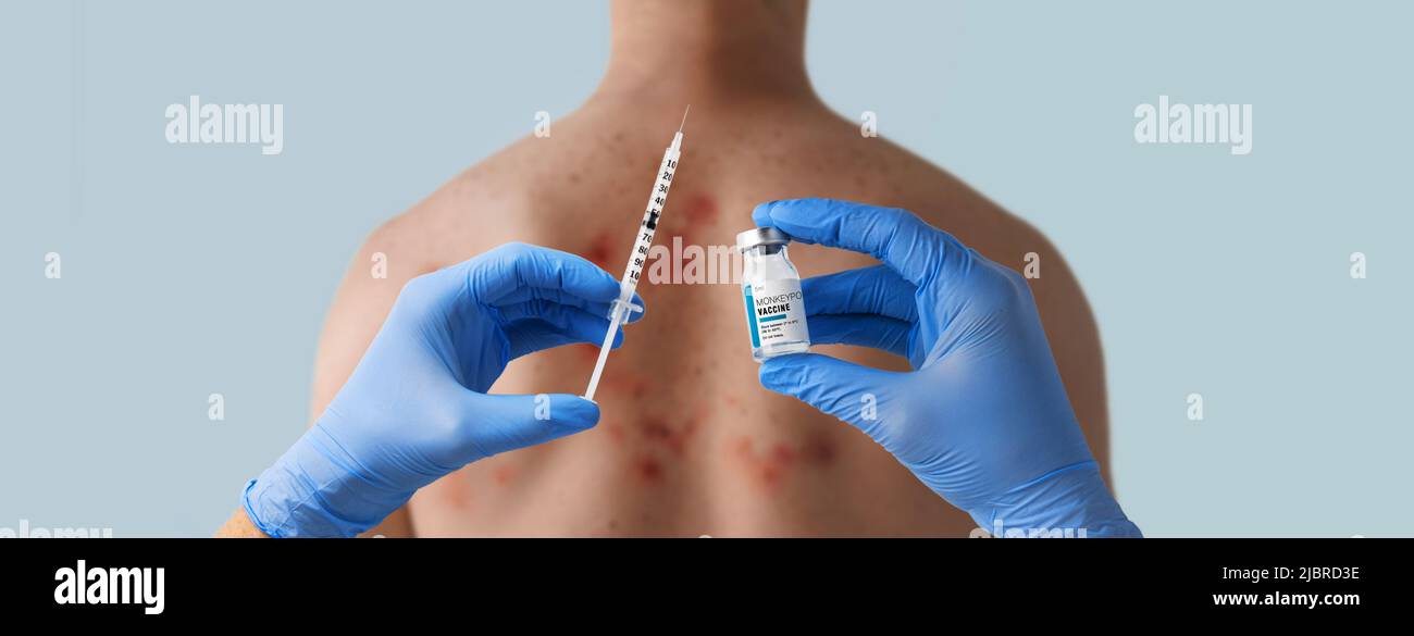 Smallpox vaccine vial hi-res stock photography and images - Alamy