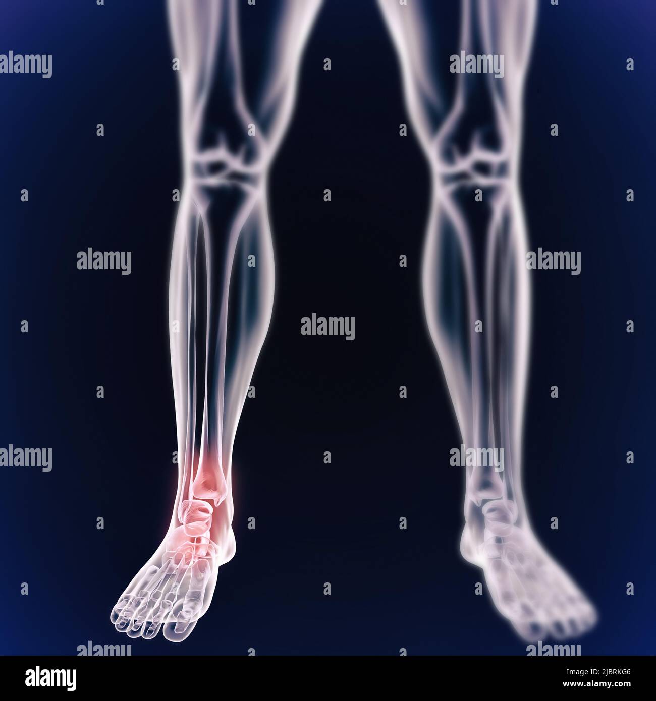 Angle and joint pains. Facing the pain of inflammation. A cgi view of ...