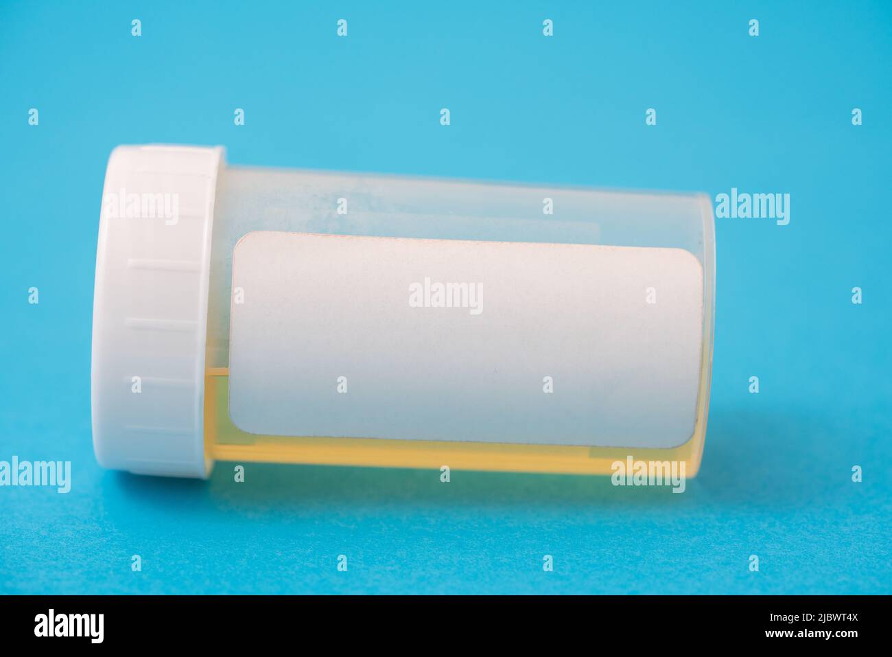 container with a urine sample for laboratory analysis Stock Photo - Alamy