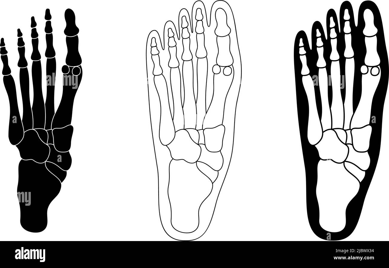 Set of foot skeleton with bones. Black foot silhouette vector ...