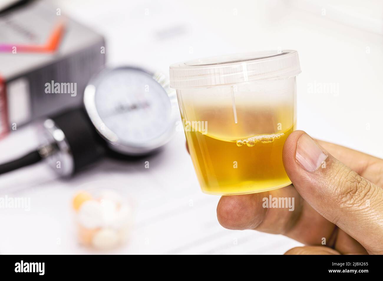 hand holding urine pot or bottle, delivering urine for medical ...