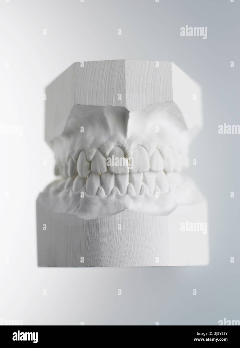 Set of plaster dental molds Stock Photo - Alamy