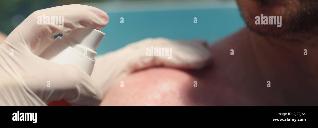 Man applying suntan lotion woman hi-res stock photography and images ...